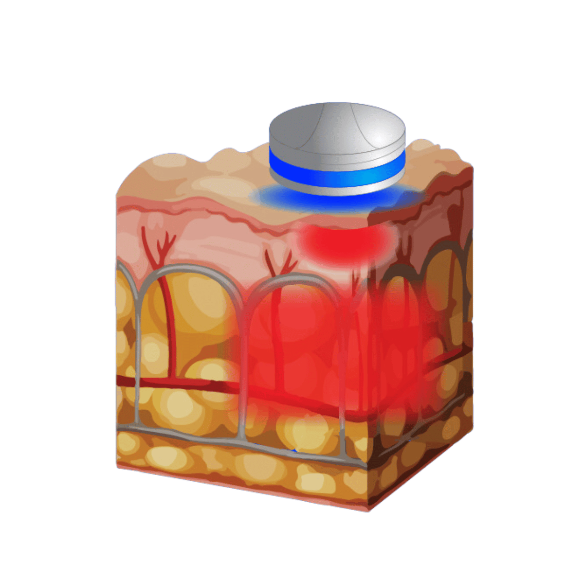 SENTIENT® SCULPT™ | Body Contouring — you+ Medical Aesthetics: Med Spa ...