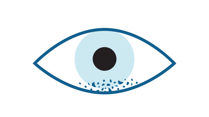 Dr Andrea Ang | Perth Ophthalmologist Laser Eye Surgeon