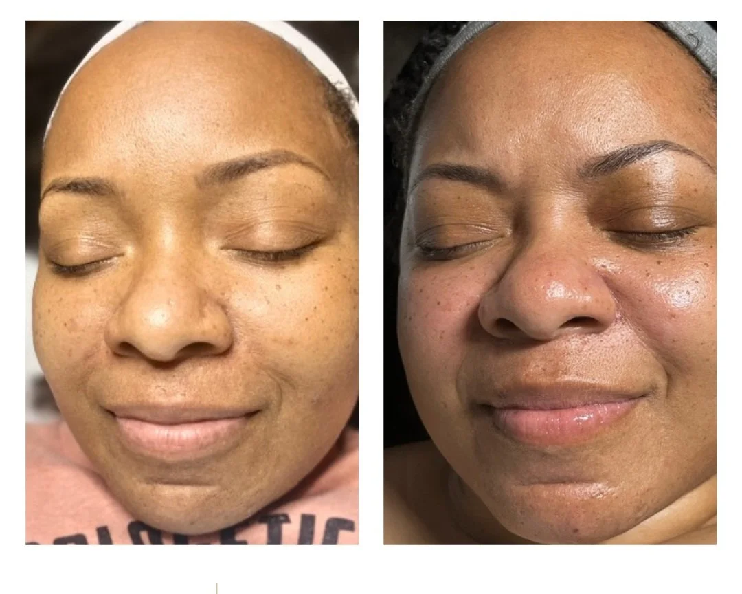 Luxe` Esthetics Studio - Home