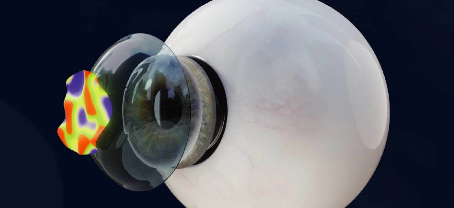 Ovitz ARES Contact Lenses | Valley Contax — We make lenses.