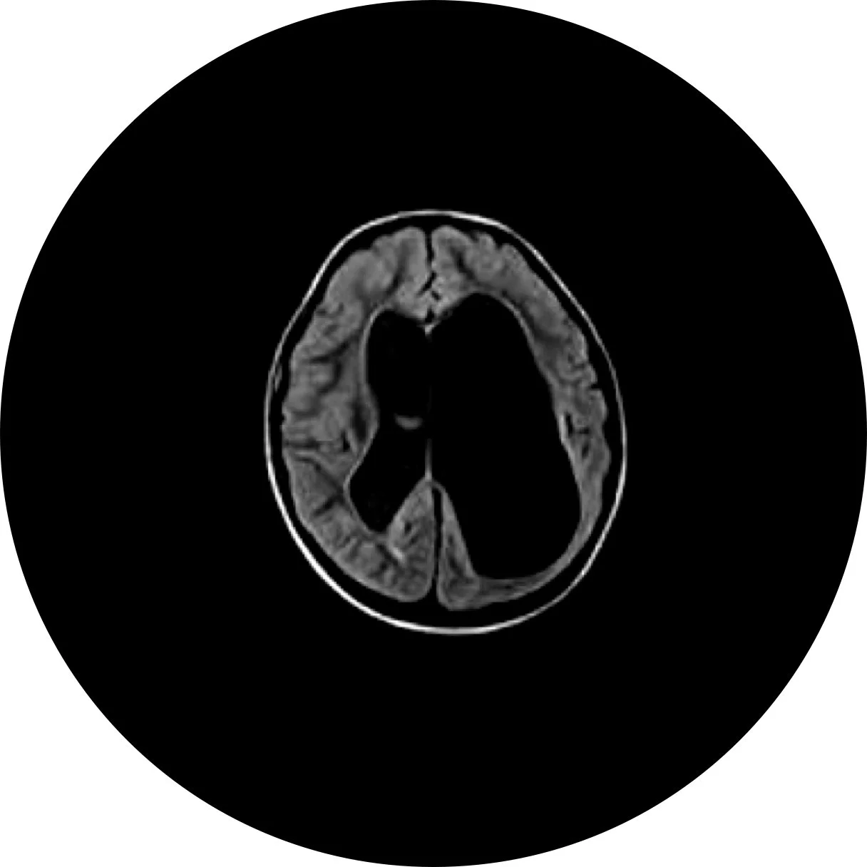 Pipeline — Bionaut