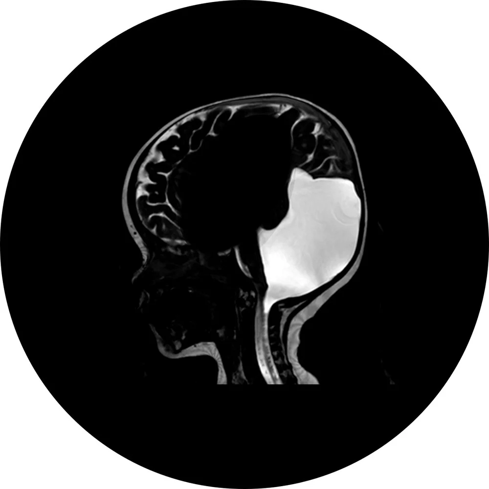 Pipeline — Bionaut