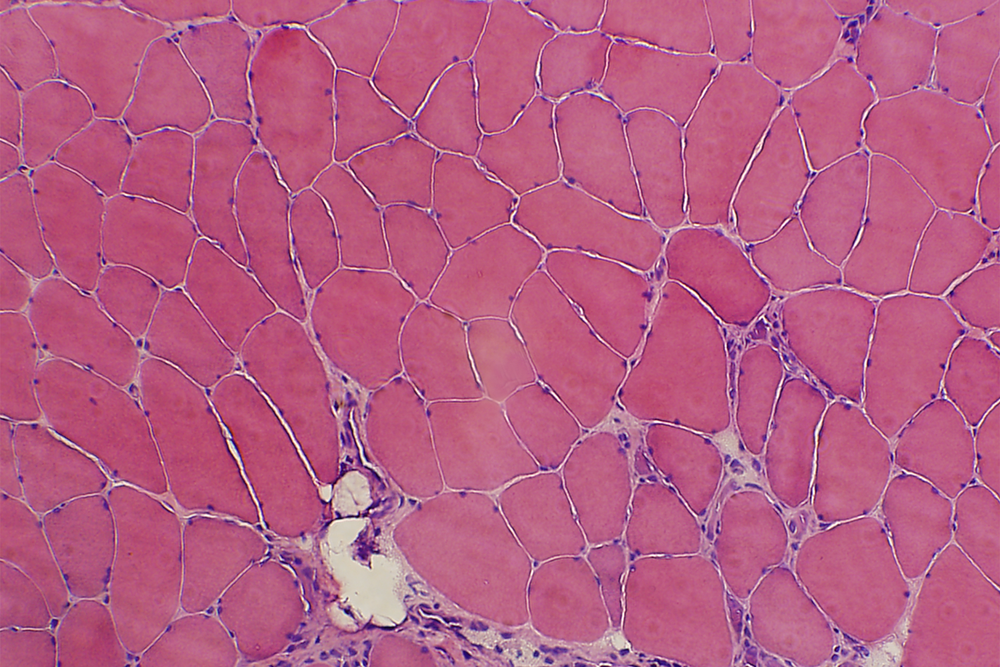 Muscle Phenotyping Stains — BIOQUANT