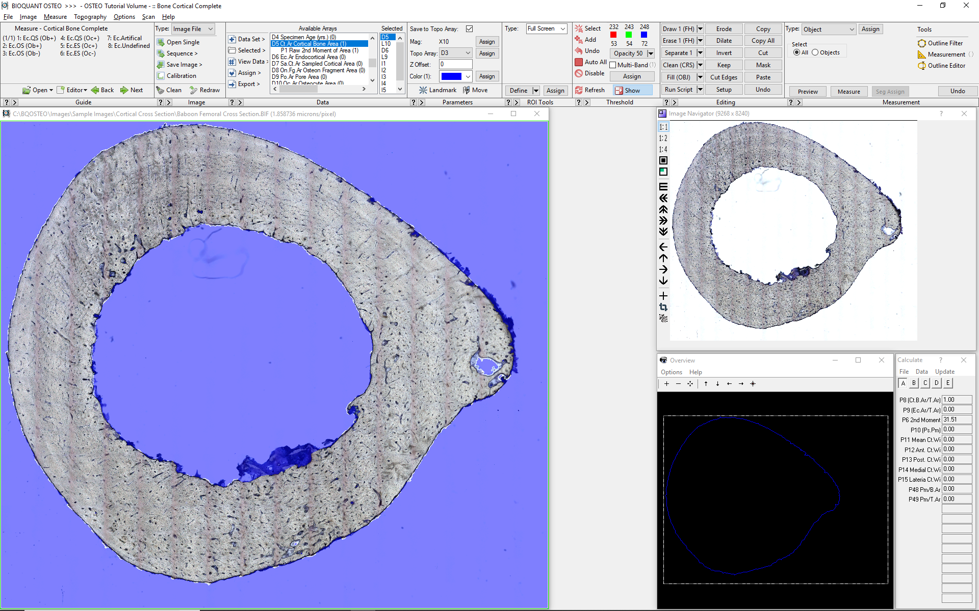 Cortical Bone Structure — BIOQUANT