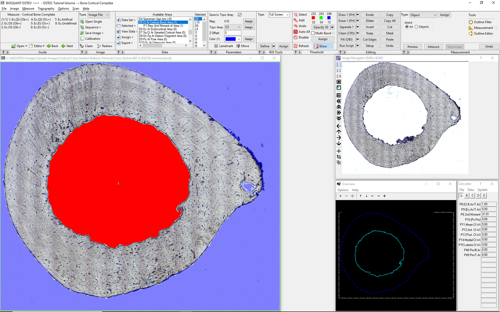 Cortical Bone Structure — BIOQUANT