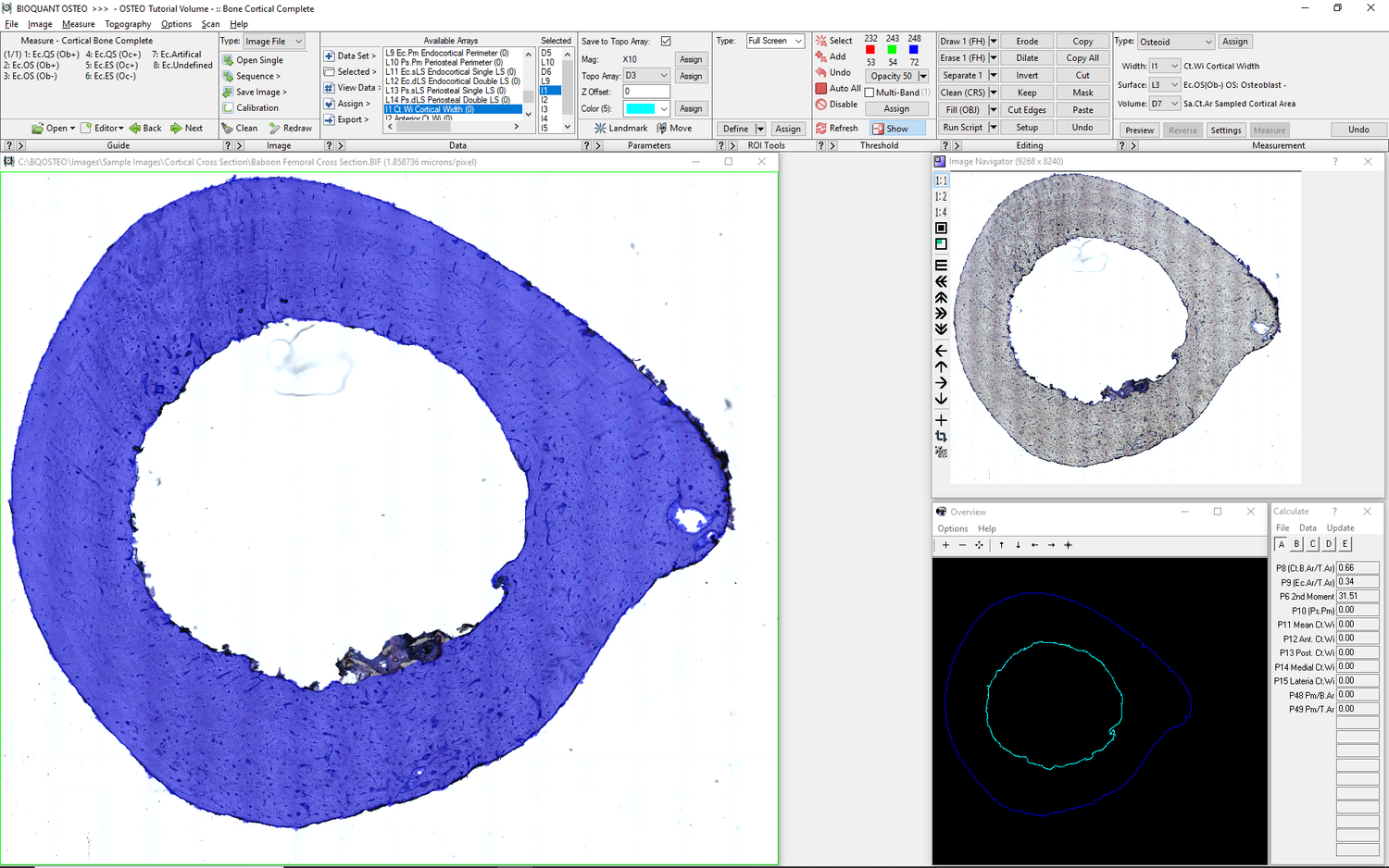 Cortical Bone Structure — BIOQUANT