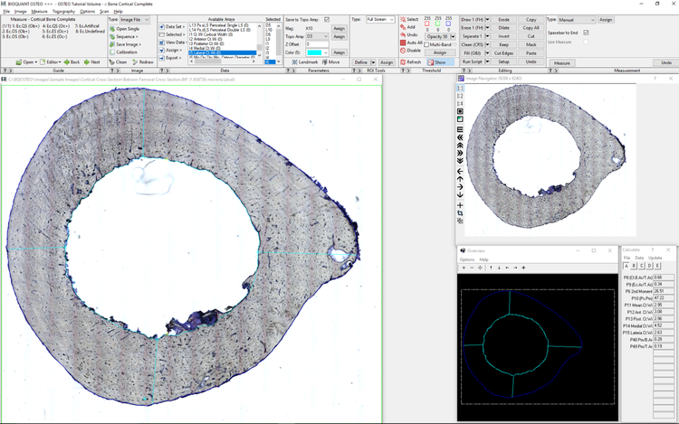 Cortical Bone Structure — BIOQUANT