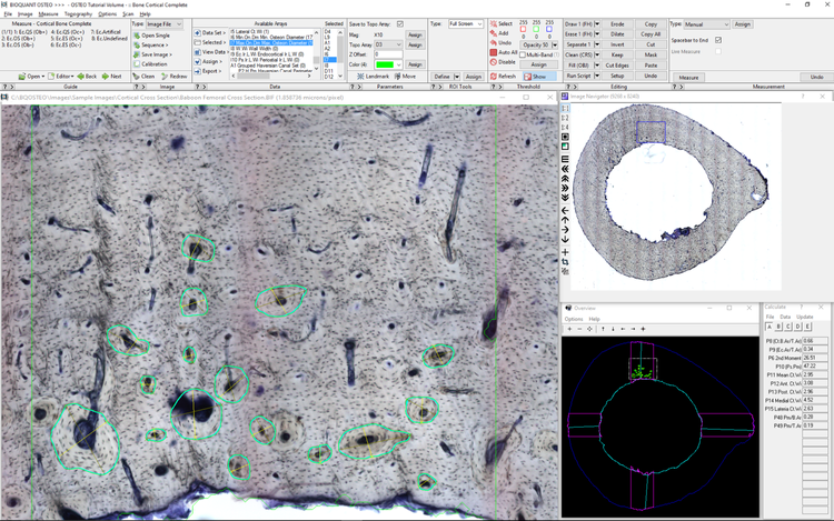 Cortical Bone Structure — BIOQUANT