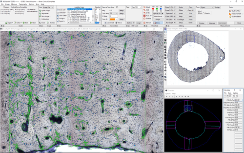 Cortical Bone Structure — BIOQUANT