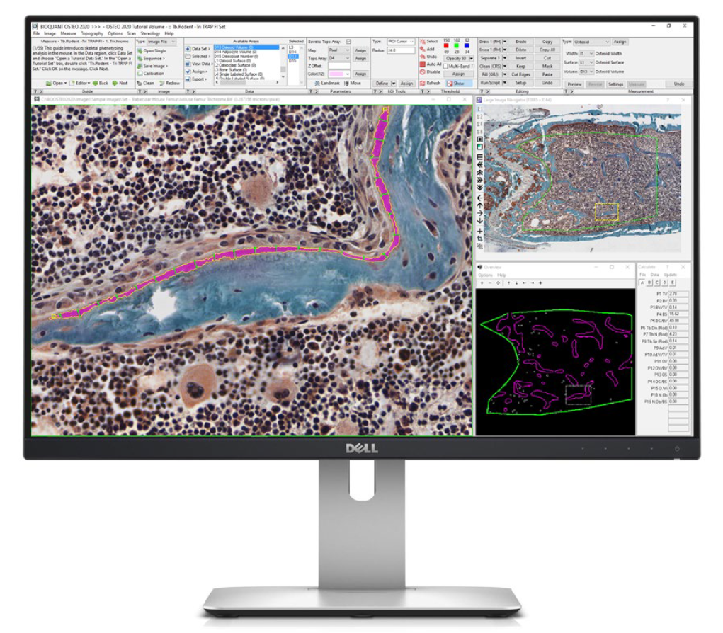 BIOQUANT OSTEO Overview — BIOQUANT