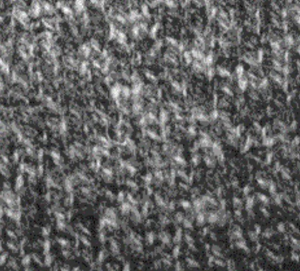 Reknitting — Amazing Garment Repair