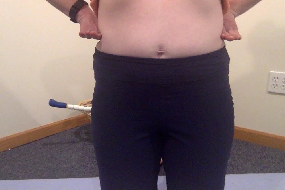 Close your diastasis recti - part 1 — New Journey Physical Therapy
