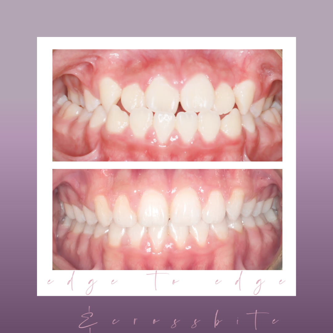DR. MARIANNE DEMIRDJI | SDORTHODONTICS | Top orthodontic provider in ...