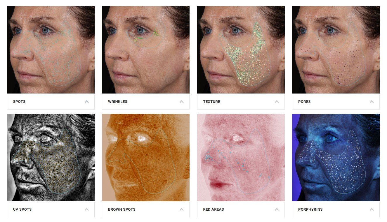 Boutik dermatology skin analysis VISA SKIN ANALYSIS — BOUTIK DERMATOLOGY