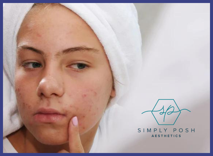 Decoding Skin pH — Simply Posh