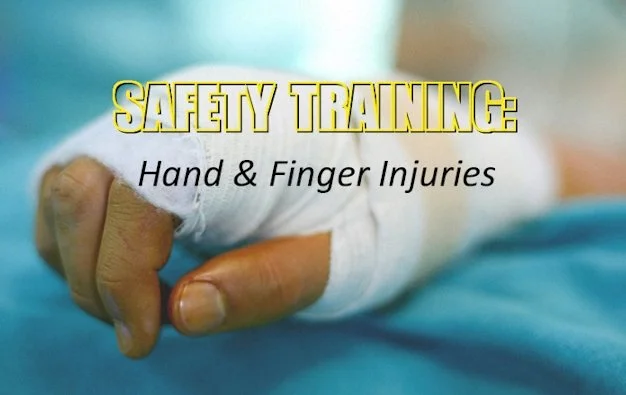 Safety Topic: Hand & Finger Injuries — Central Welding Supply