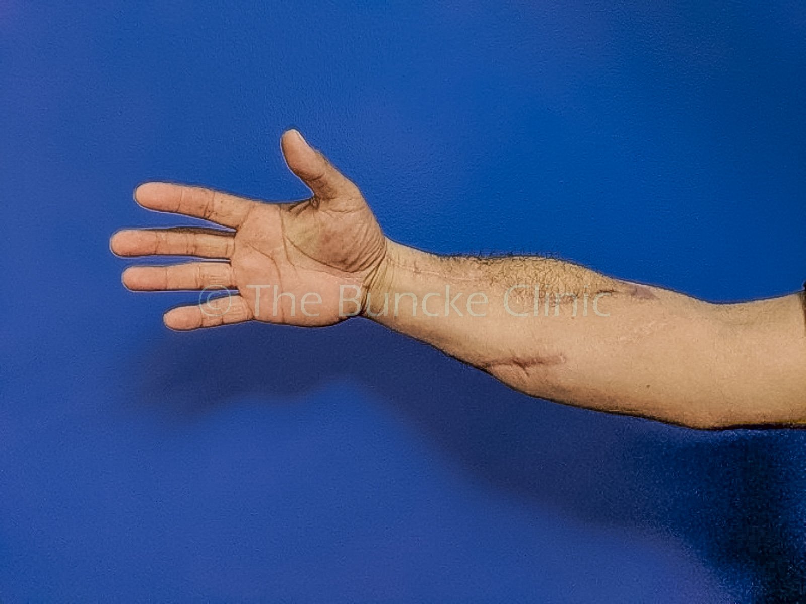 Reconstructive Microsurgeons — The Buncke Clinic