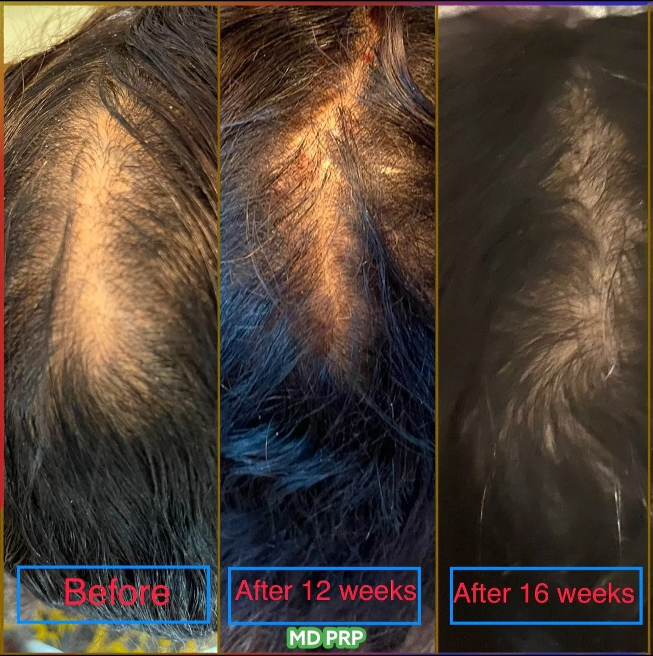 Testimonials/Gallery — MD PRP