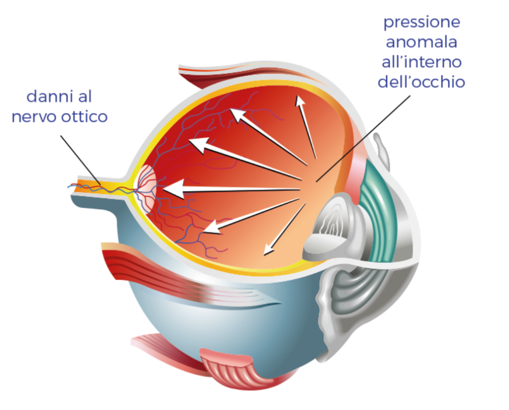Pressione oculare e salute della vista | Oculista Dott. Andrea Passani