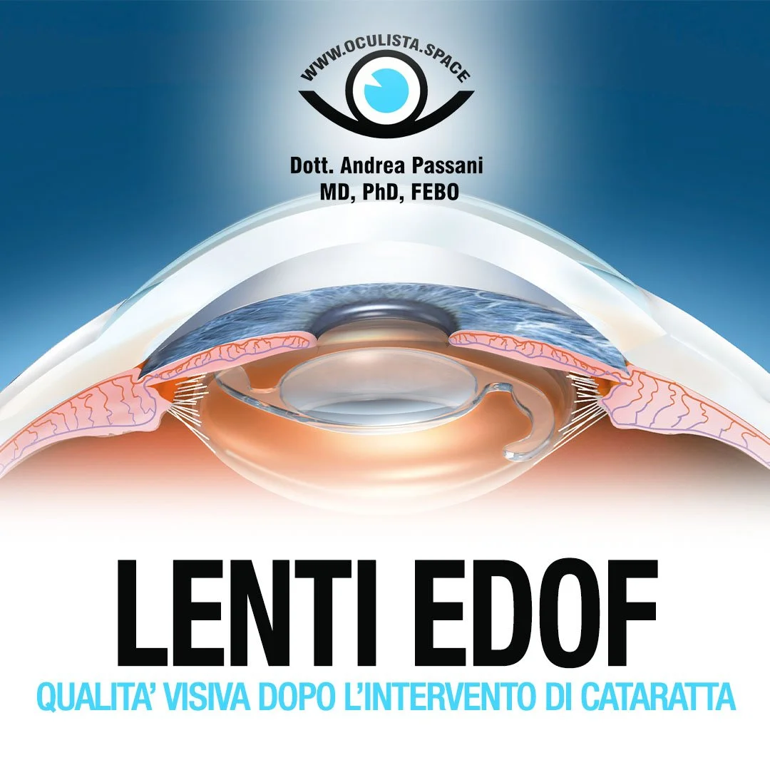 Lenti EDOF: qualità visiva dopo la Cataratta | Dott. Andrea Passani
