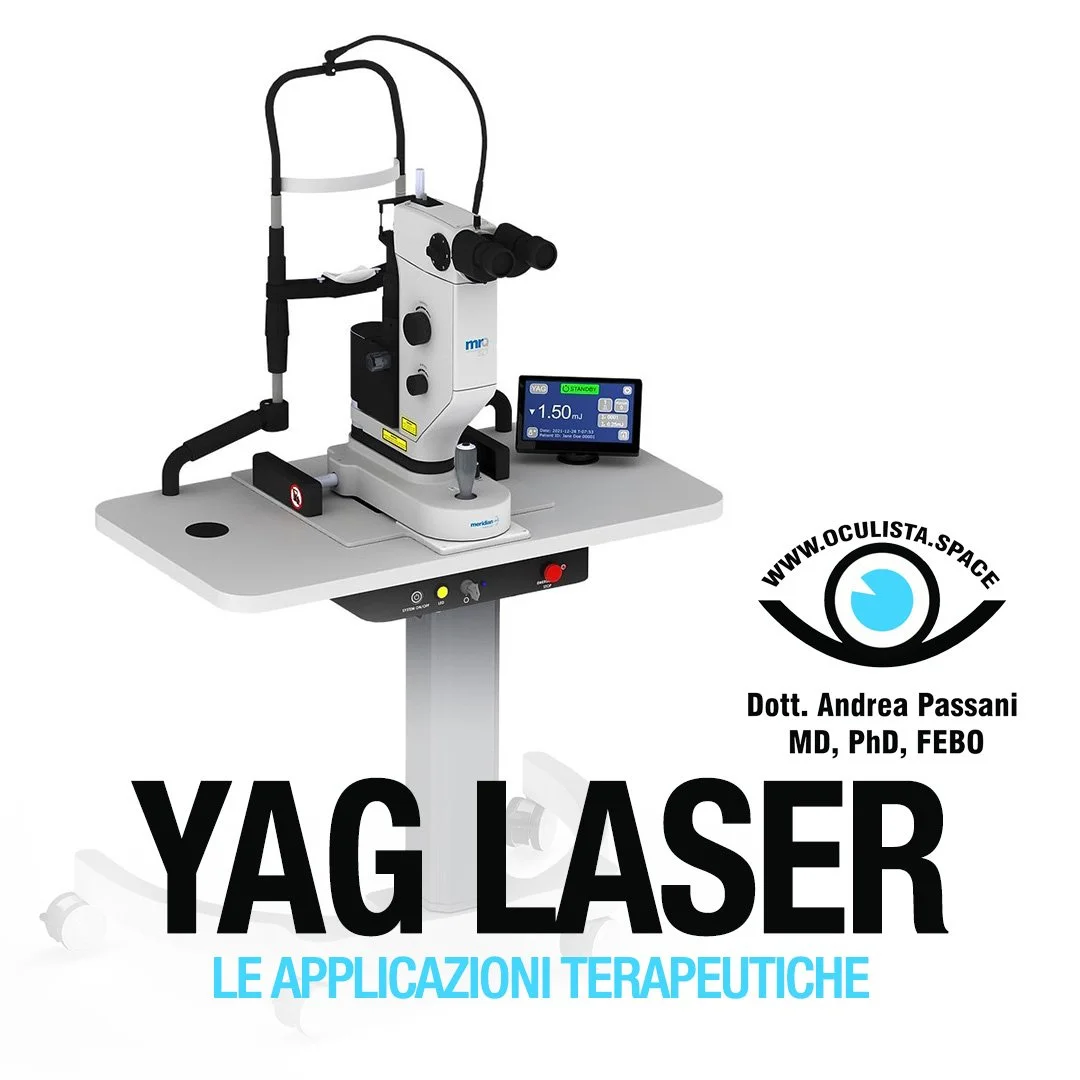YAG LASER: applicazioni terapeutiche | Oculista Dott. Andrea Passani