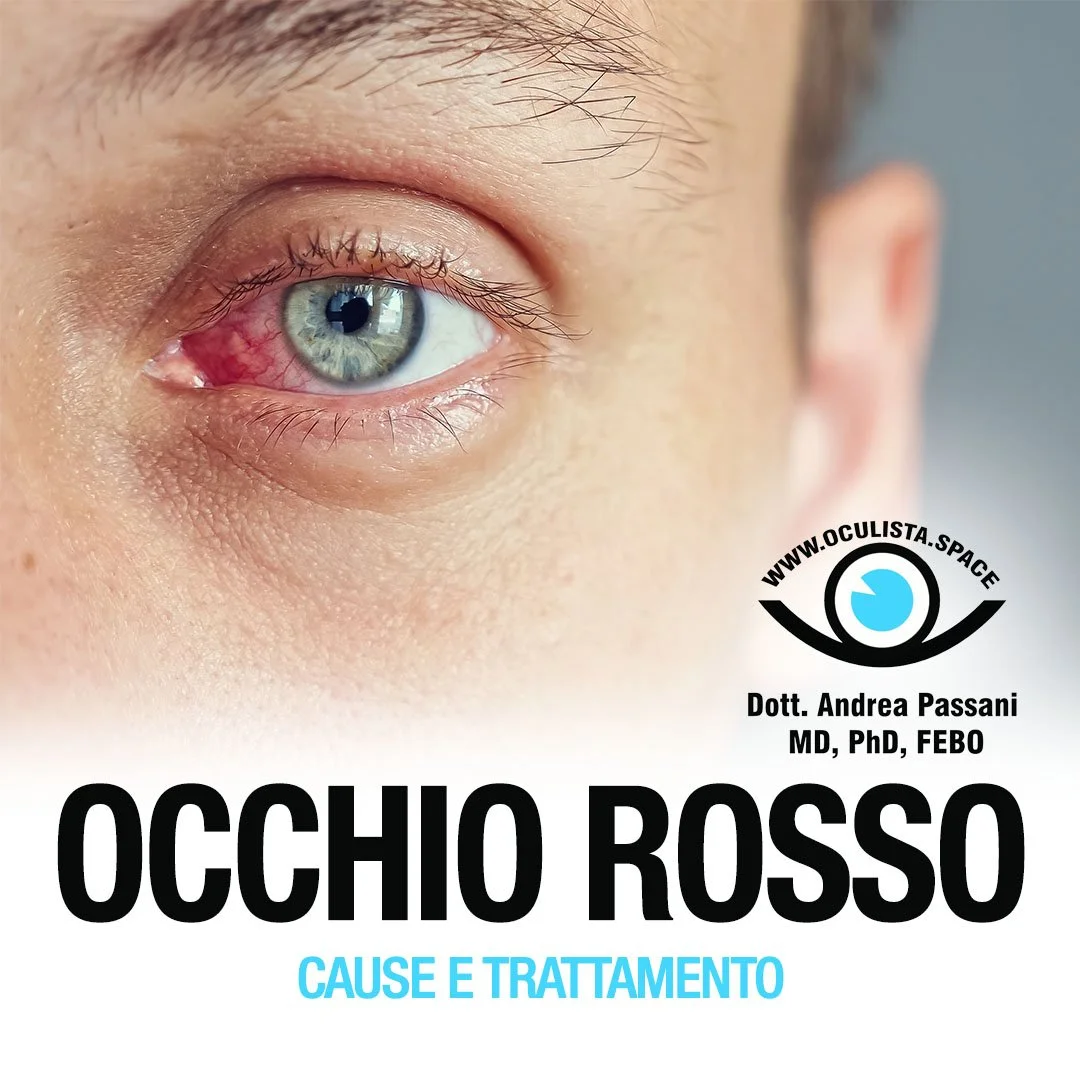 Occhio Rosso: Cause, Sintomi e Cura | Oculista Dott. Andrea Passani