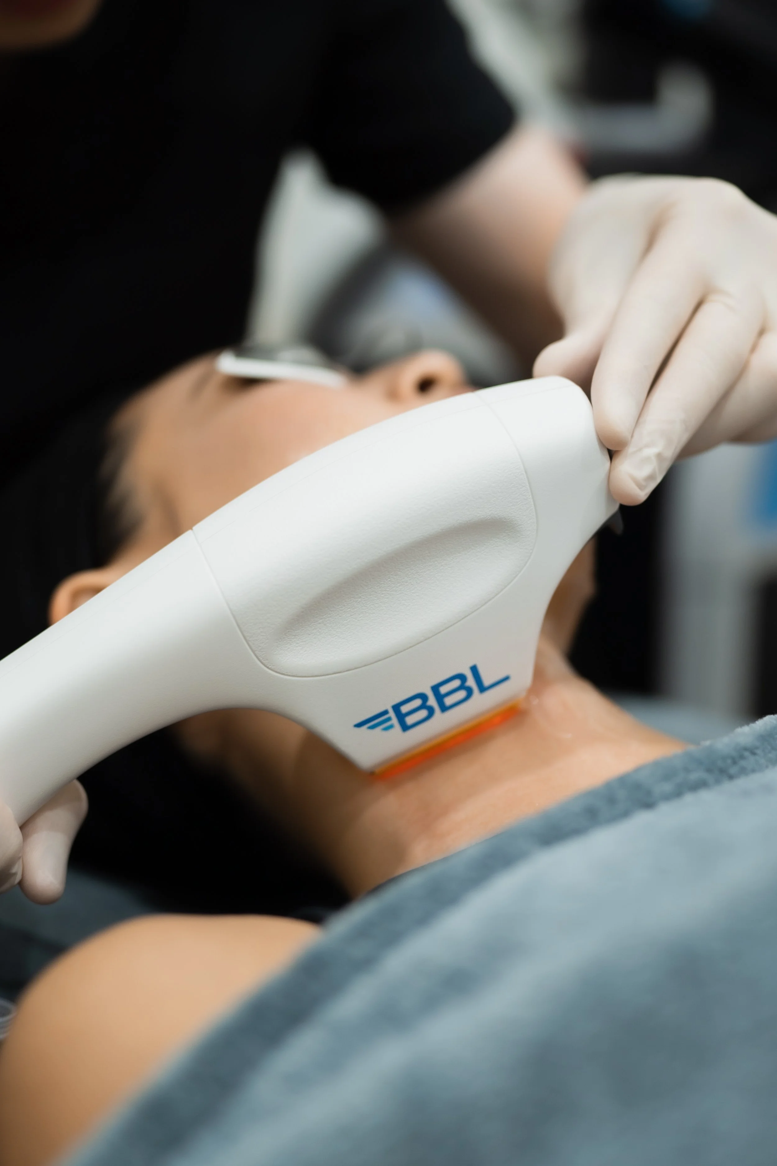 BBL HERO Singapore | Skin Rejuvenation | Acclaro Medical Aesthetics ...