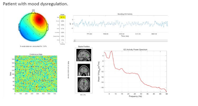 What are brain maps? | A detailed practical overview — Foothills ...