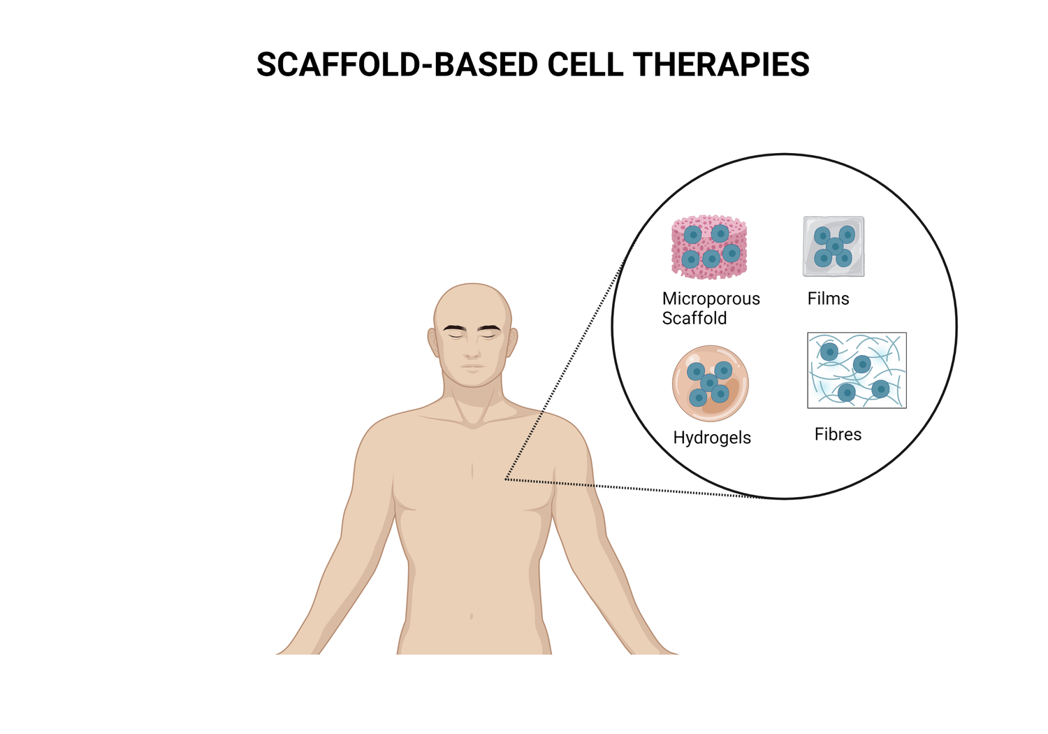 Cell therapies — CureCell