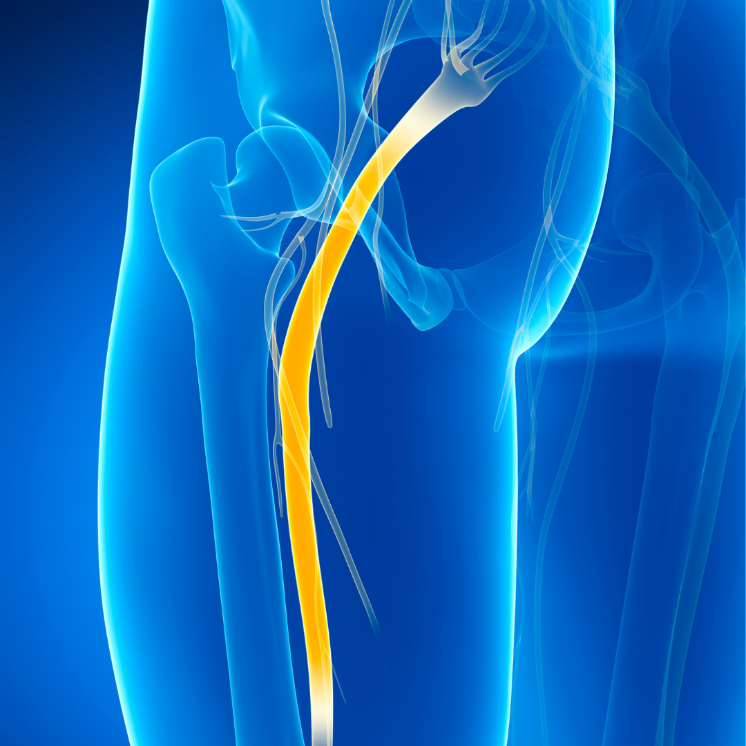 The Disc Doctors Sciatica Nerve Pain the-disc-doctors-sciatica-nerve-pain
