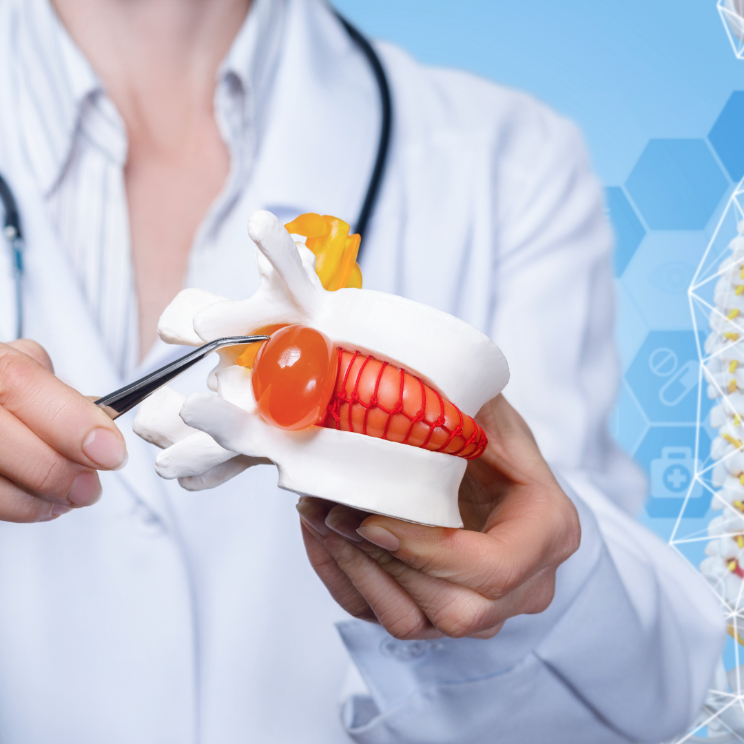 The Disc Doctors-Herniated Disc