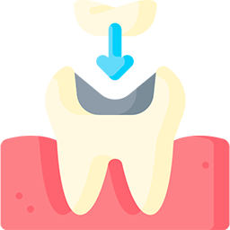 Fillings — HTL Dental