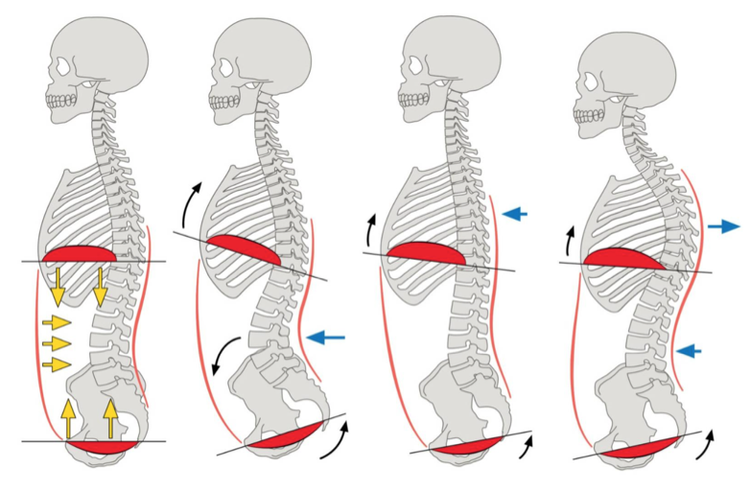 Anterior Pelvic Tilt? Add this to your routine — Erica Friedman Wellness