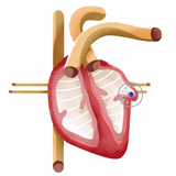 The WATCHMAN — Capital Cardiology Associates