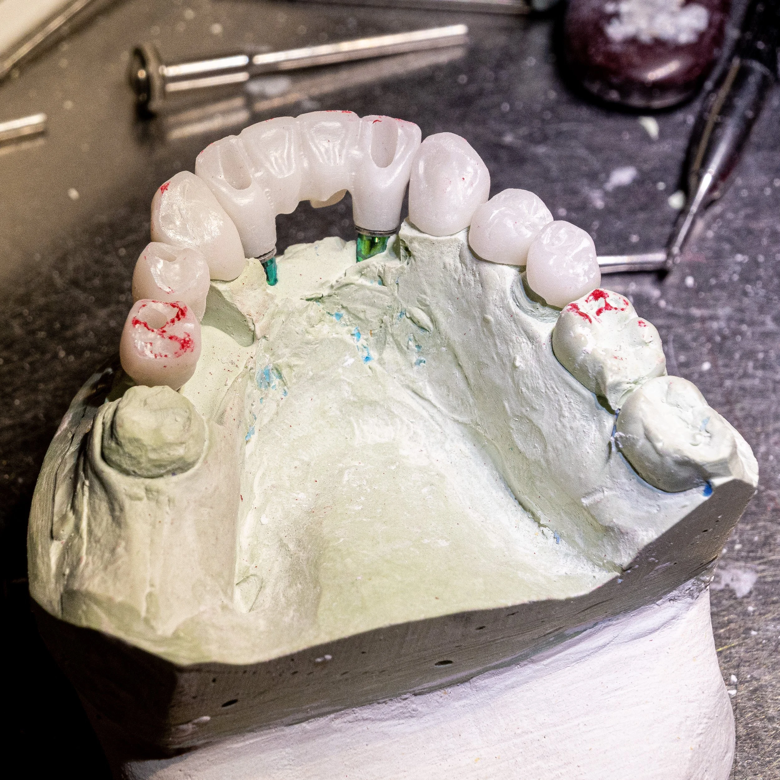 Expert Dental Fixed Solutions Technicians — Dental Science Lab