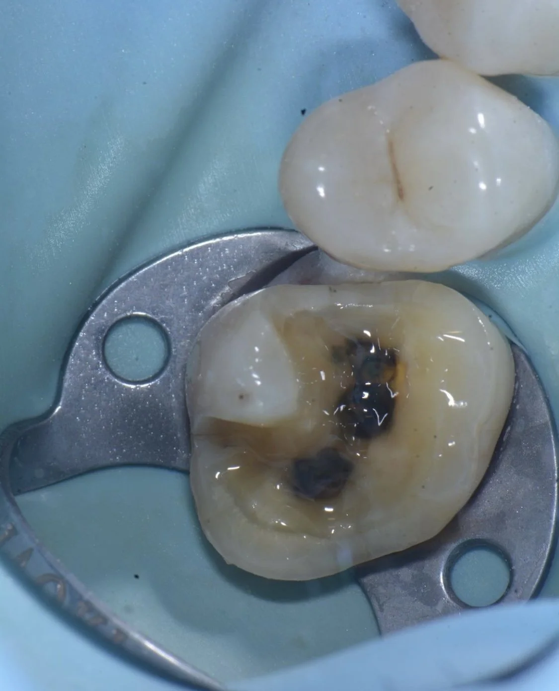 Examples of Work — Alleman Dental
