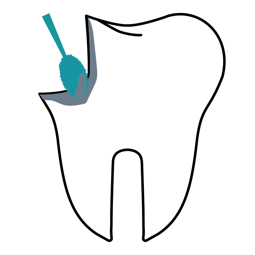 What is Biomimetic Dentistry — Alleman Dental