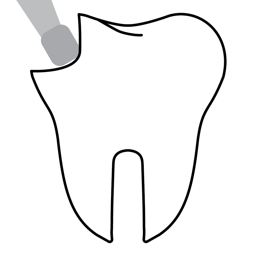 What is Biomimetic Dentistry — Alleman Dental
