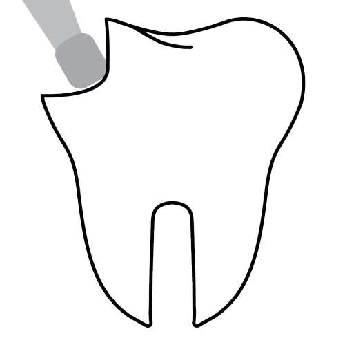 What is Biomimetic Dentistry — Alleman Dental