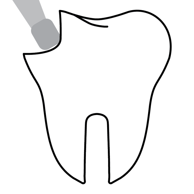 What is Biomimetic Dentistry — Alleman Dental