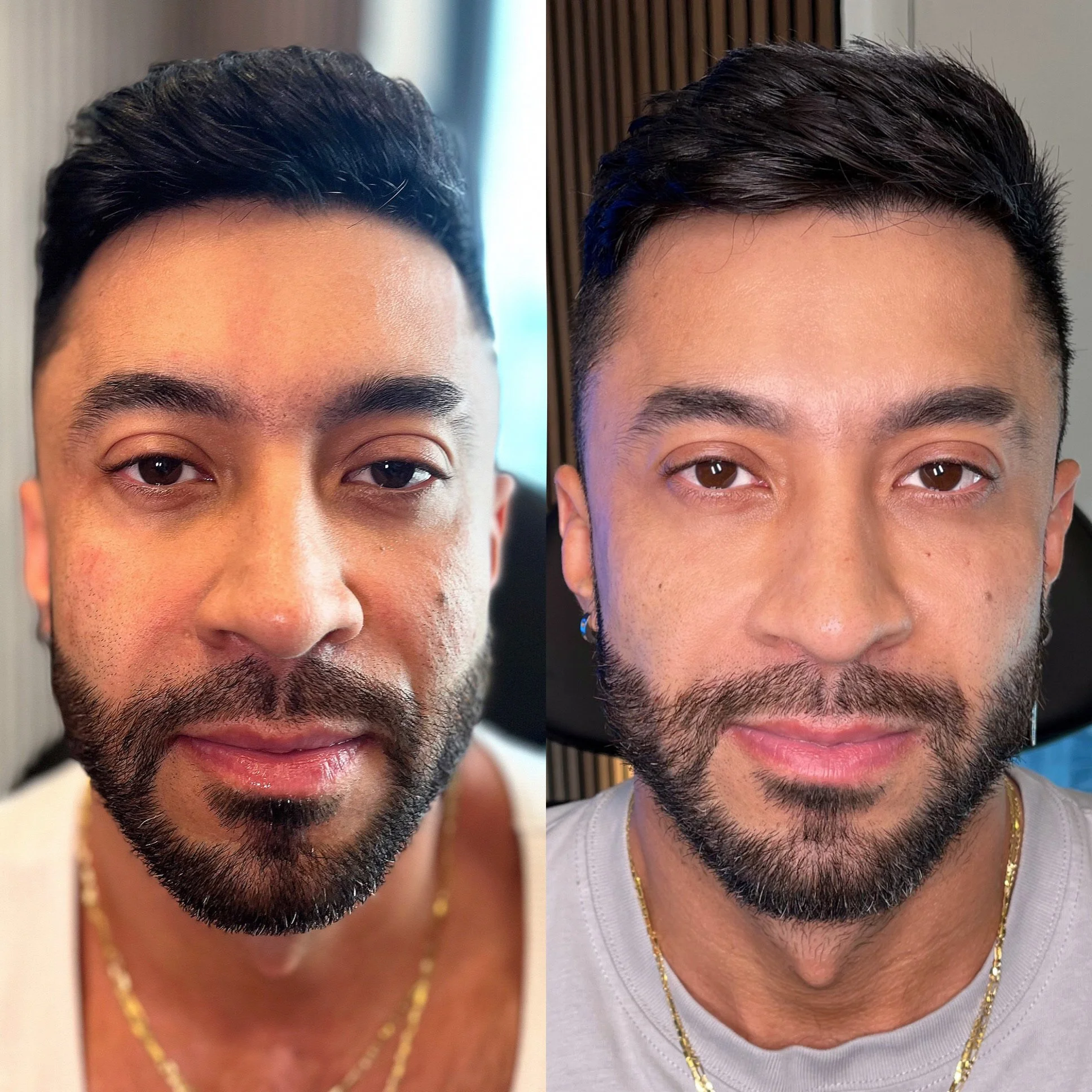 Randy Lindgren Aesthetic Rejuvenation