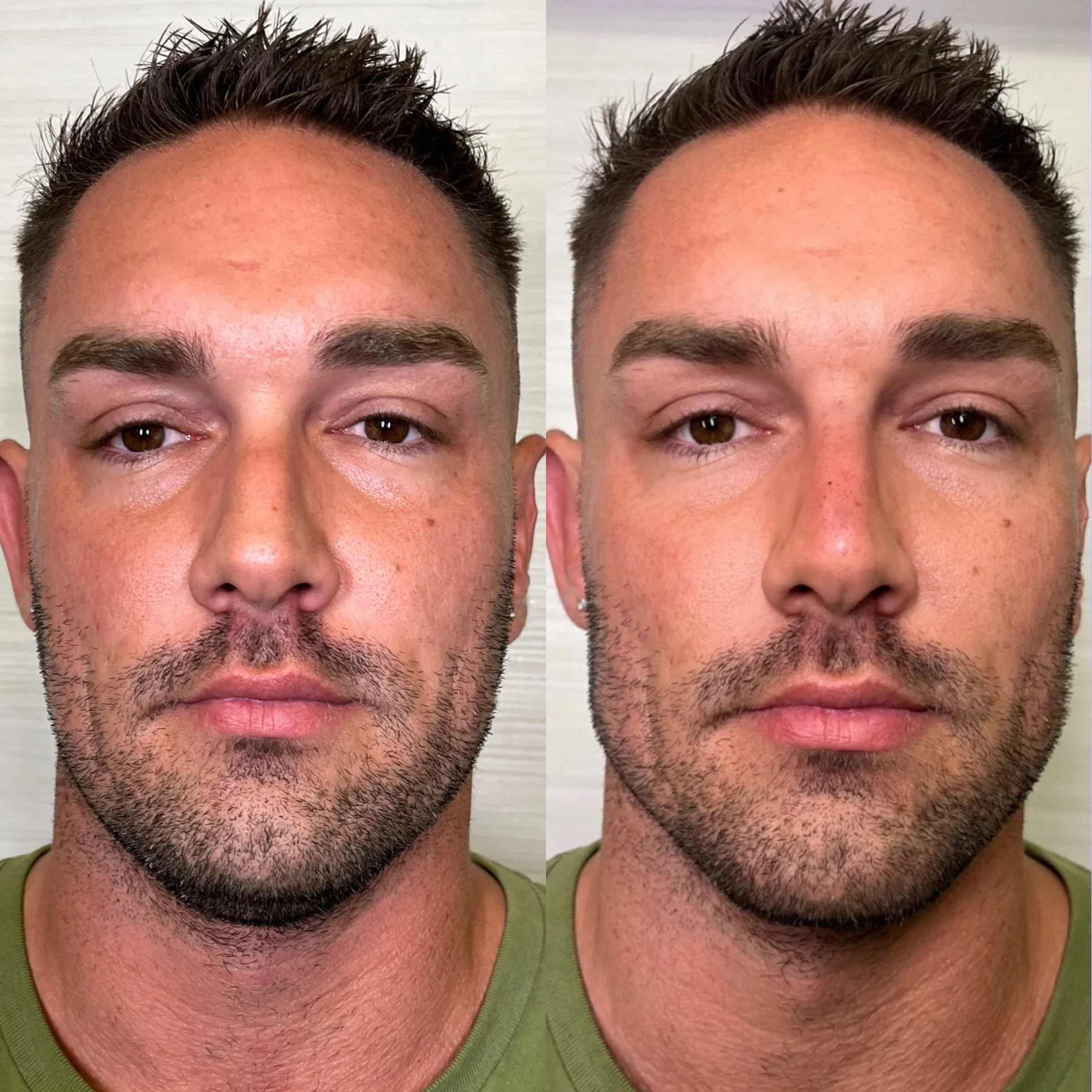 Randy Lindgren Aesthetic Rejuvenation