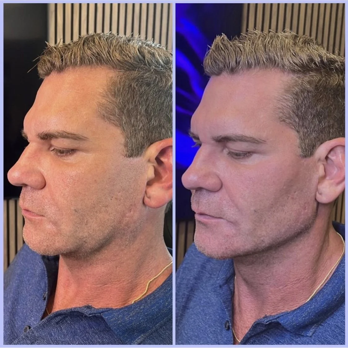 Randy Lindgren Aesthetic Rejuvenation