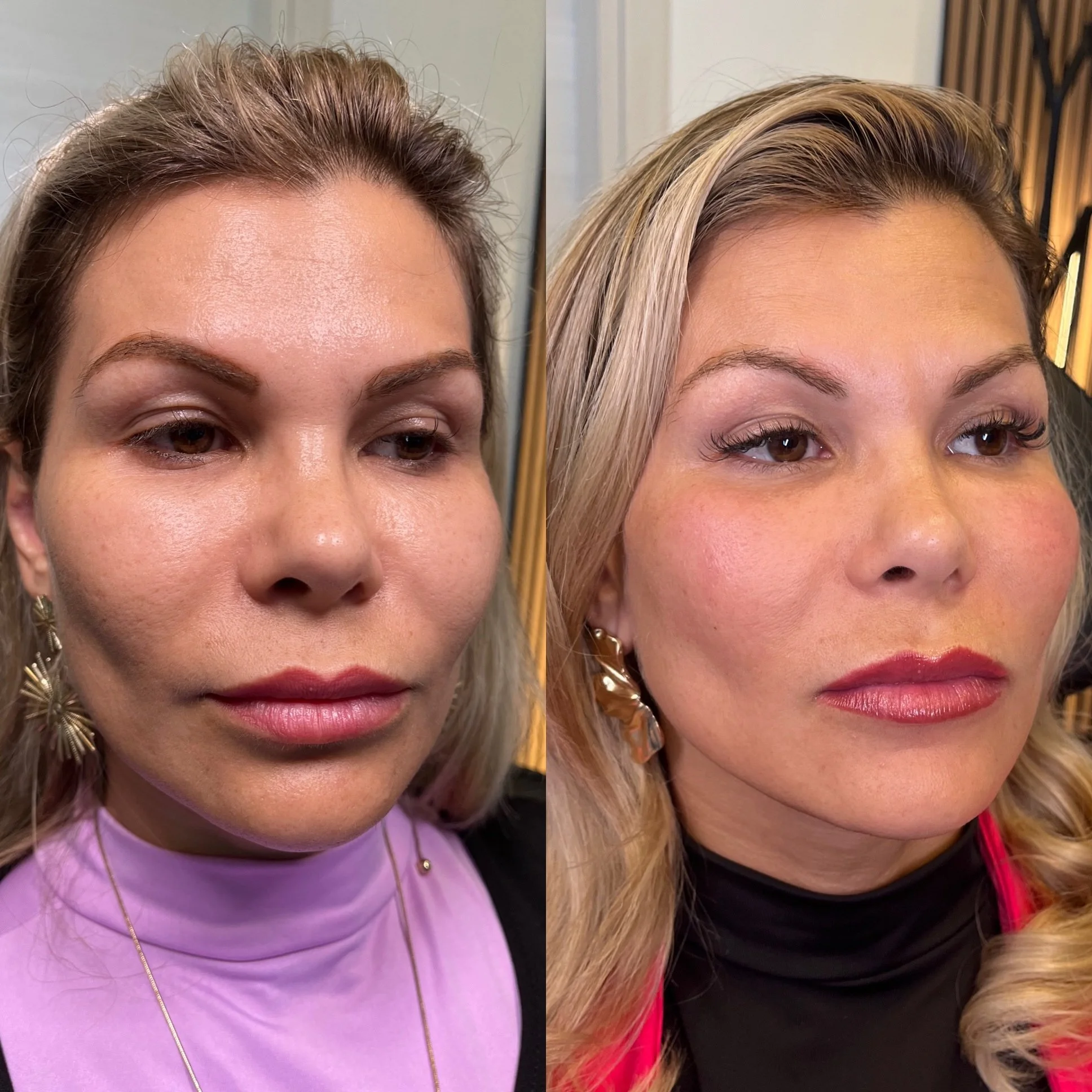 Randy Lindgren Aesthetic Rejuvenation
