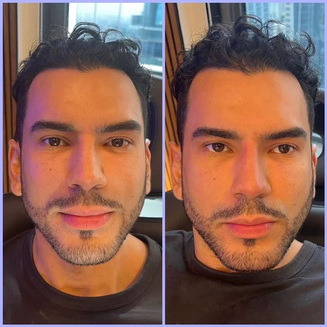 Randy Lindgren Aesthetic Rejuvenation