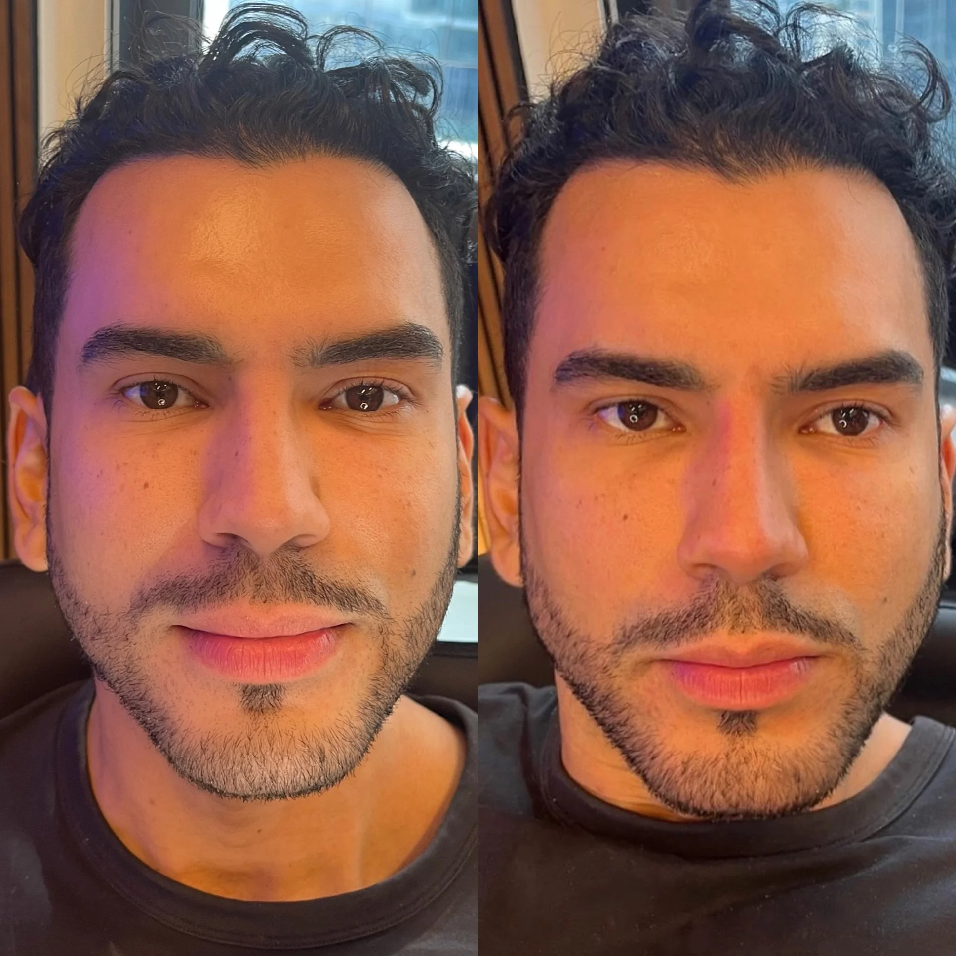 Randy Lindgren Aesthetic Rejuvenation