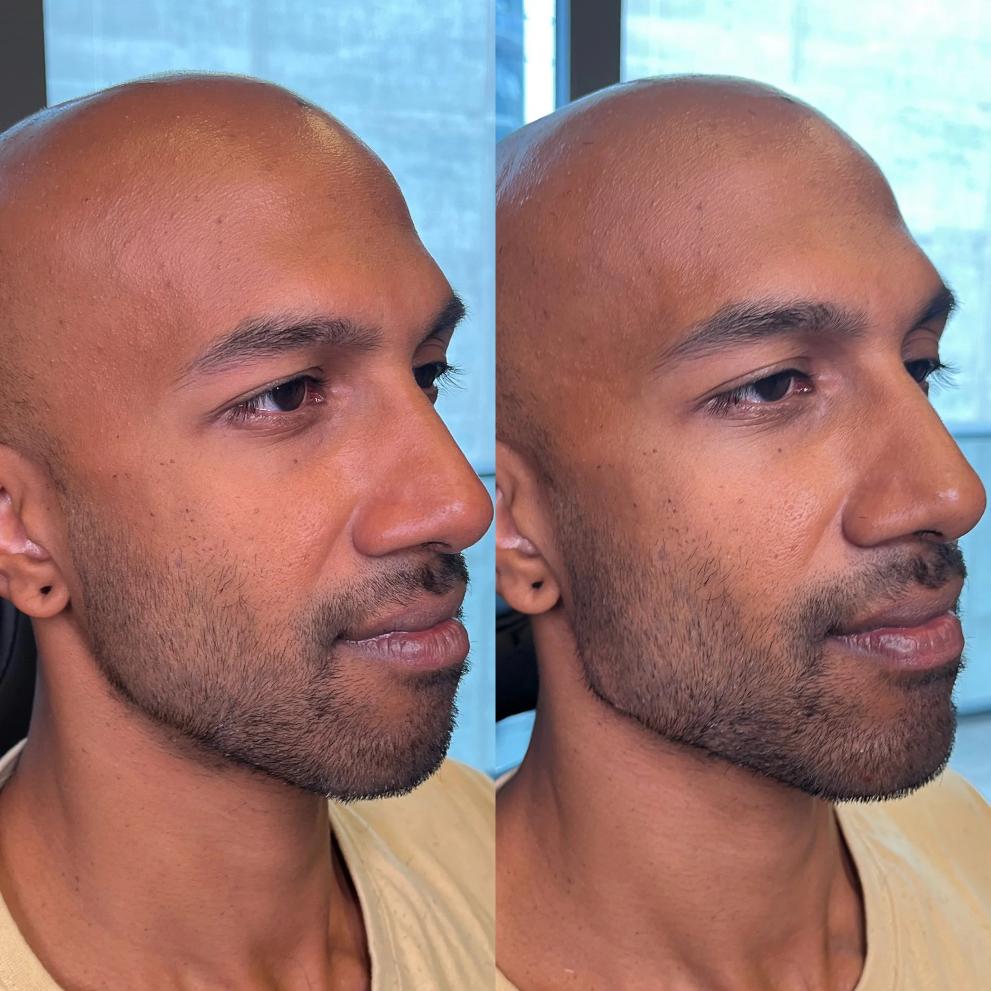 Randy Lindgren Aesthetic Rejuvenation