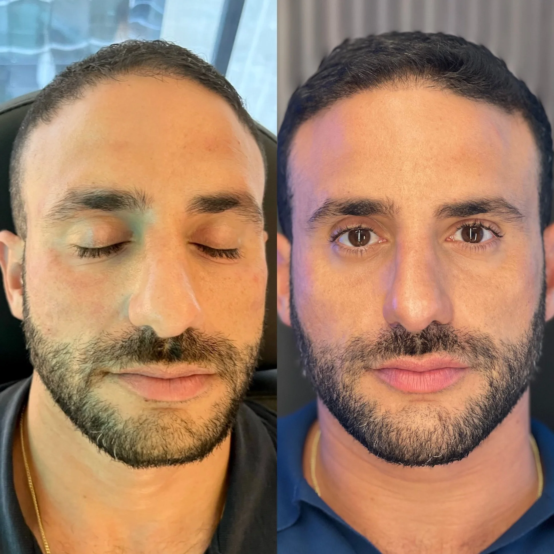 Randy Lindgren Aesthetic Rejuvenation