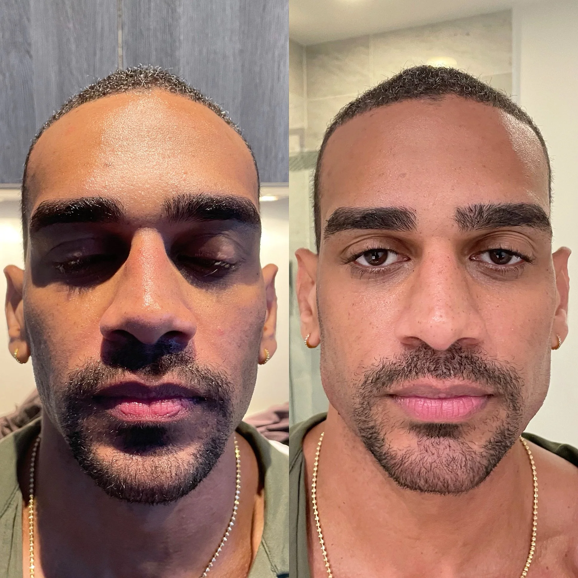 Randy Lindgren Aesthetic Rejuvenation