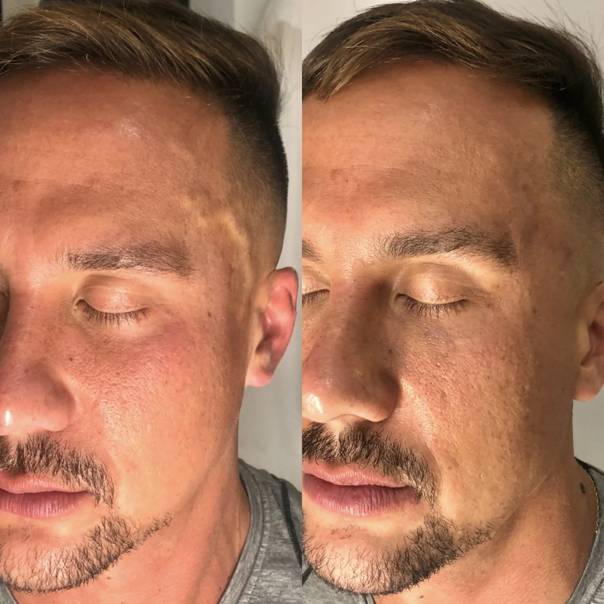 Randy Lindgren Aesthetic Rejuvenation